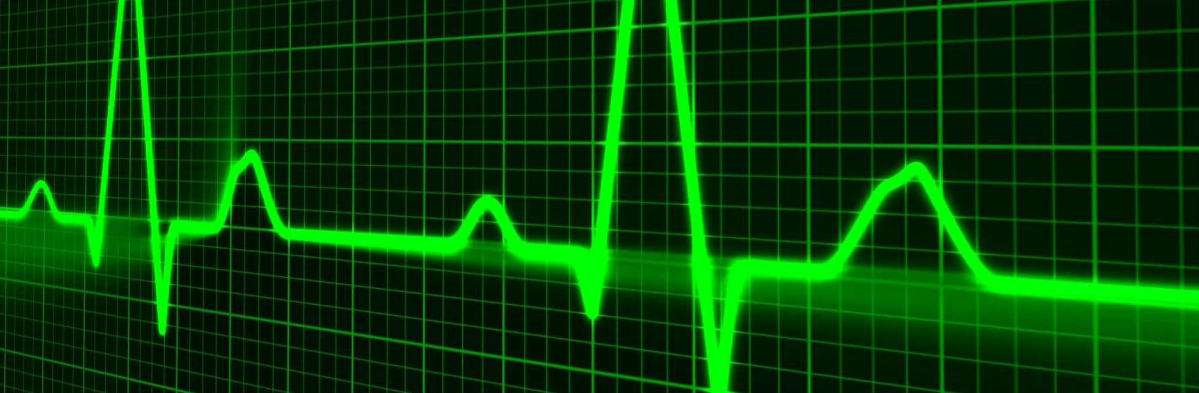 Cardiologs et le deep learning sur les électrocardiogrammes ...