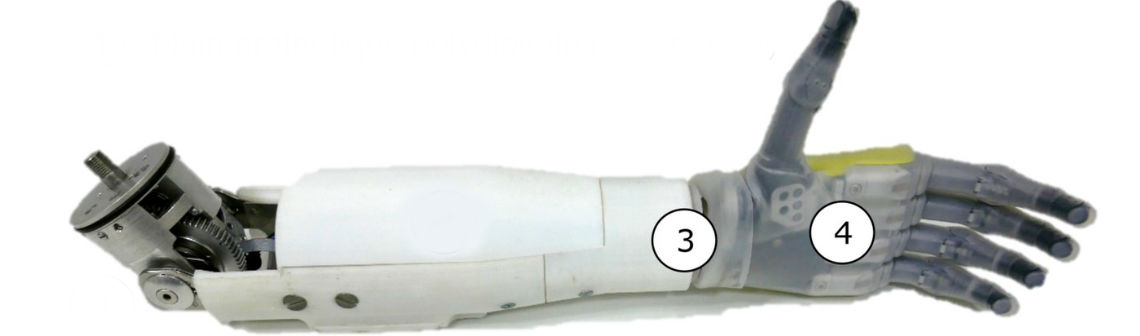 Une prothèse de bras qui décode les mouvements du membre fantôme ...