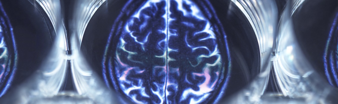 Ces nanofils révèlent les mystères des astrocytes | Techniques de l ...