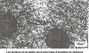 Fontes à graphite sphéroïdal : Fontes à matrice particulière ...